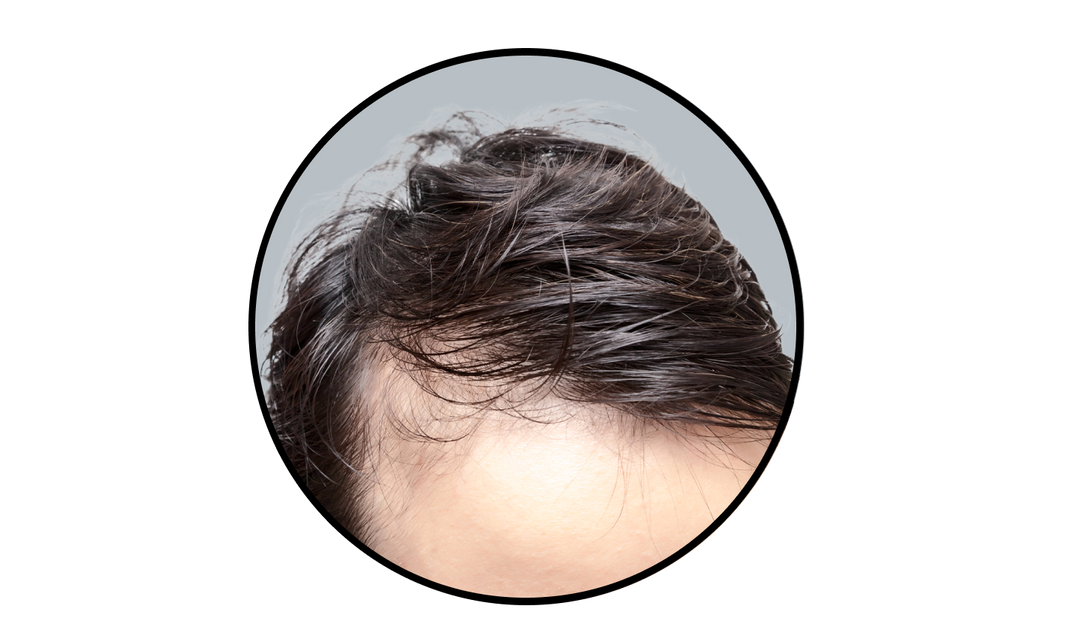 Instant Hair Lift Kit